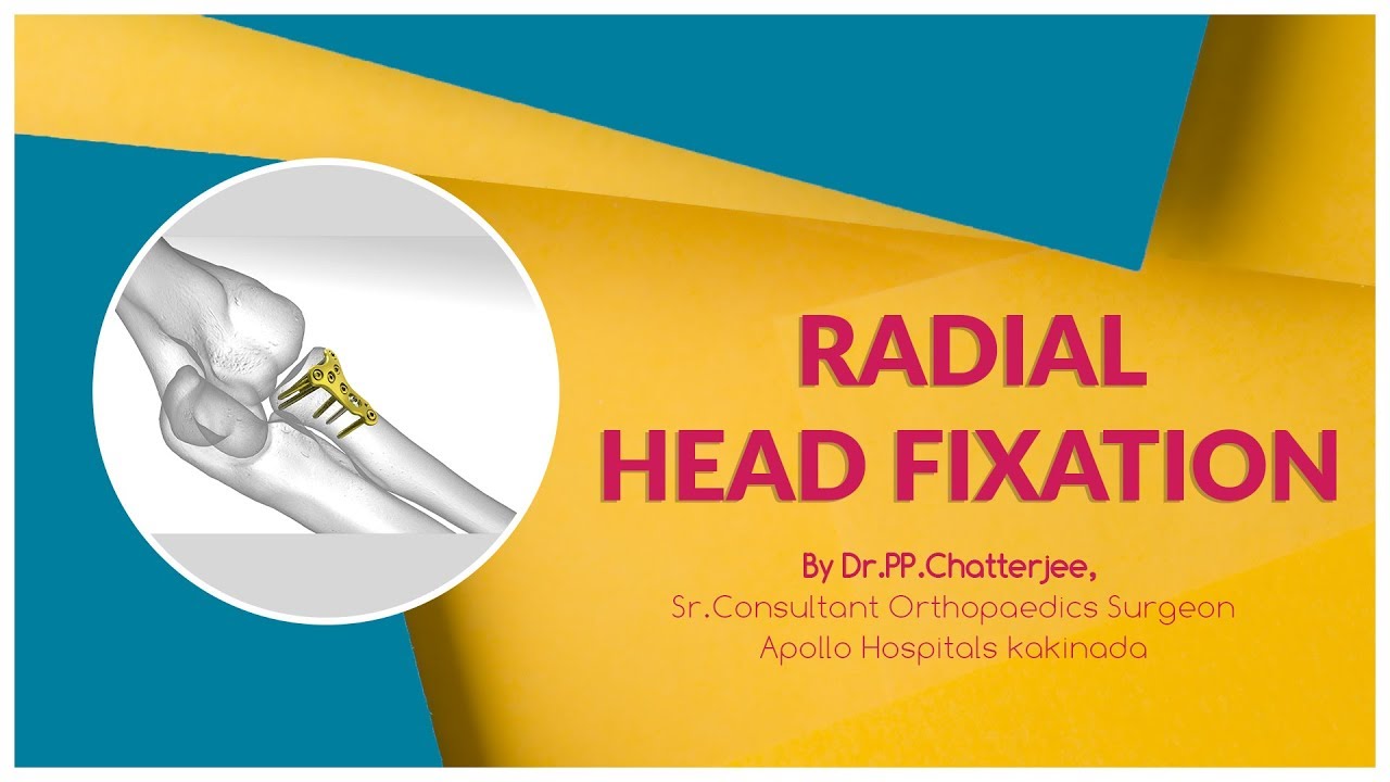 Dr.PP.Chatterjee || Sr.Consultant Orthopaedics Surgeon || Radial Head ...