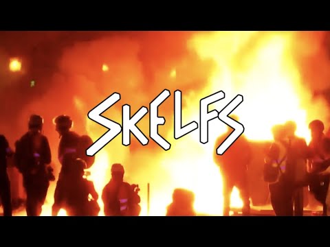 Skelfs - R.A.G.E (Official Video) - YouTube