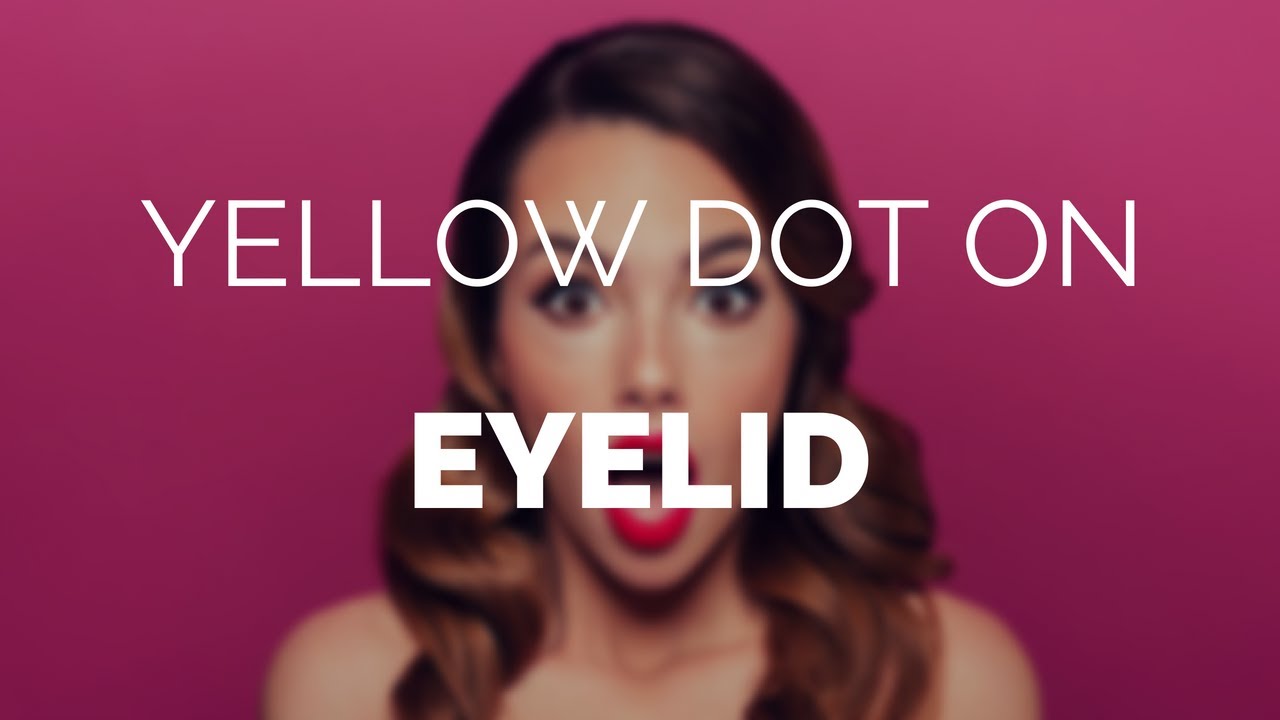 Yellow Dot On Eyelid Is It The Start Of Xanthelasma YouTube yellow-dot-on-eyelid-is-it-the-start-of-xanthelasma-youtube