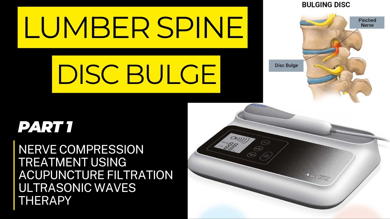 Lumber spine disc bulge and nerve compression treatment with ...