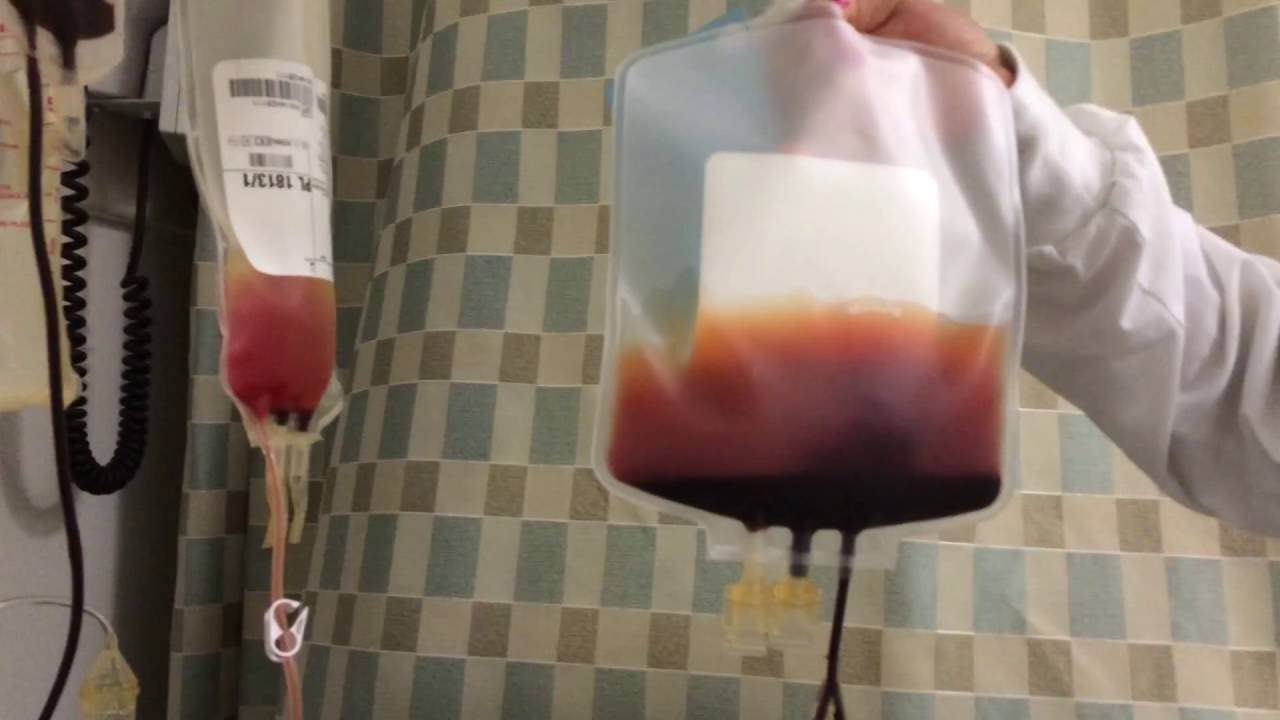 Stem Cell Collection Day #1 - YouTube