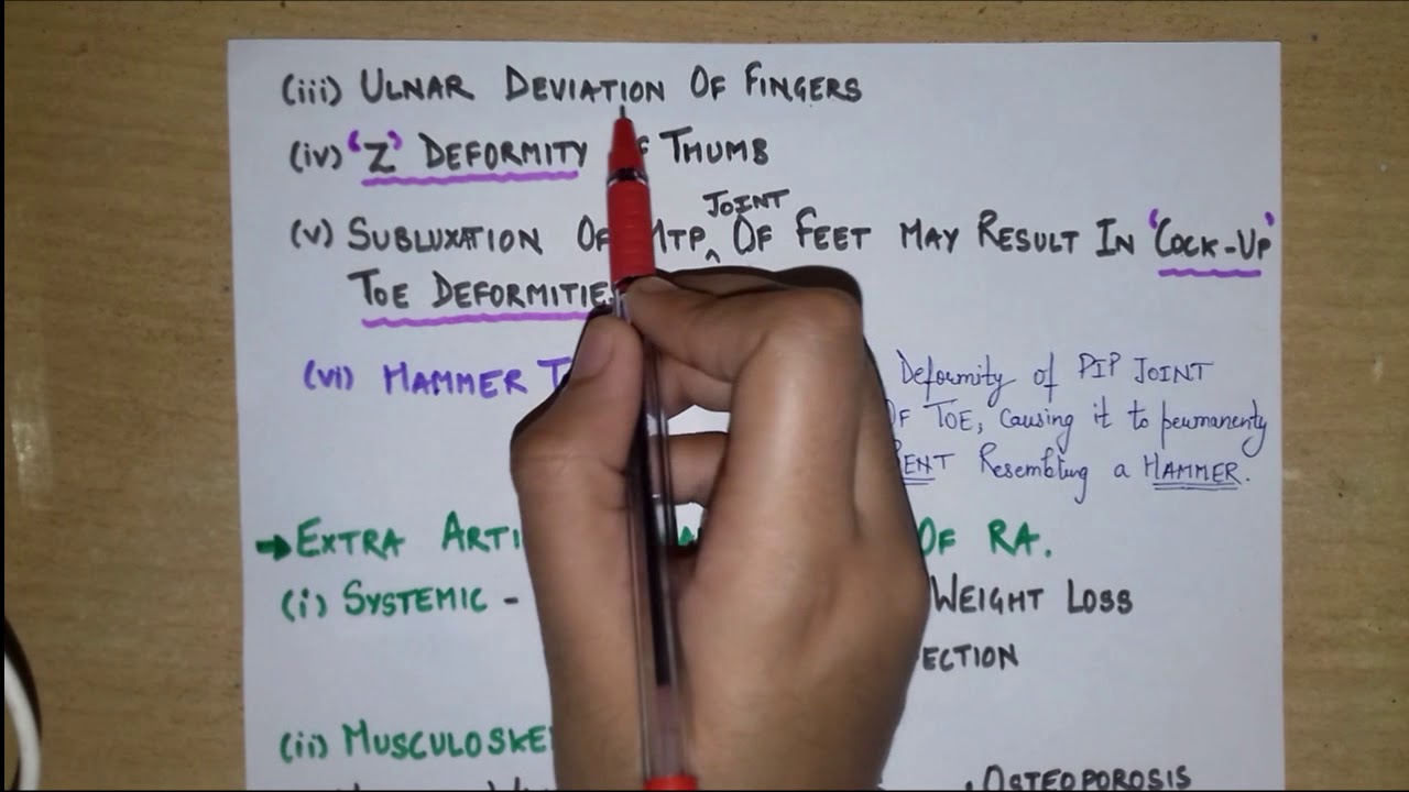 What is rheumatoid arthritis Part 2- clinical features(articular and ...
