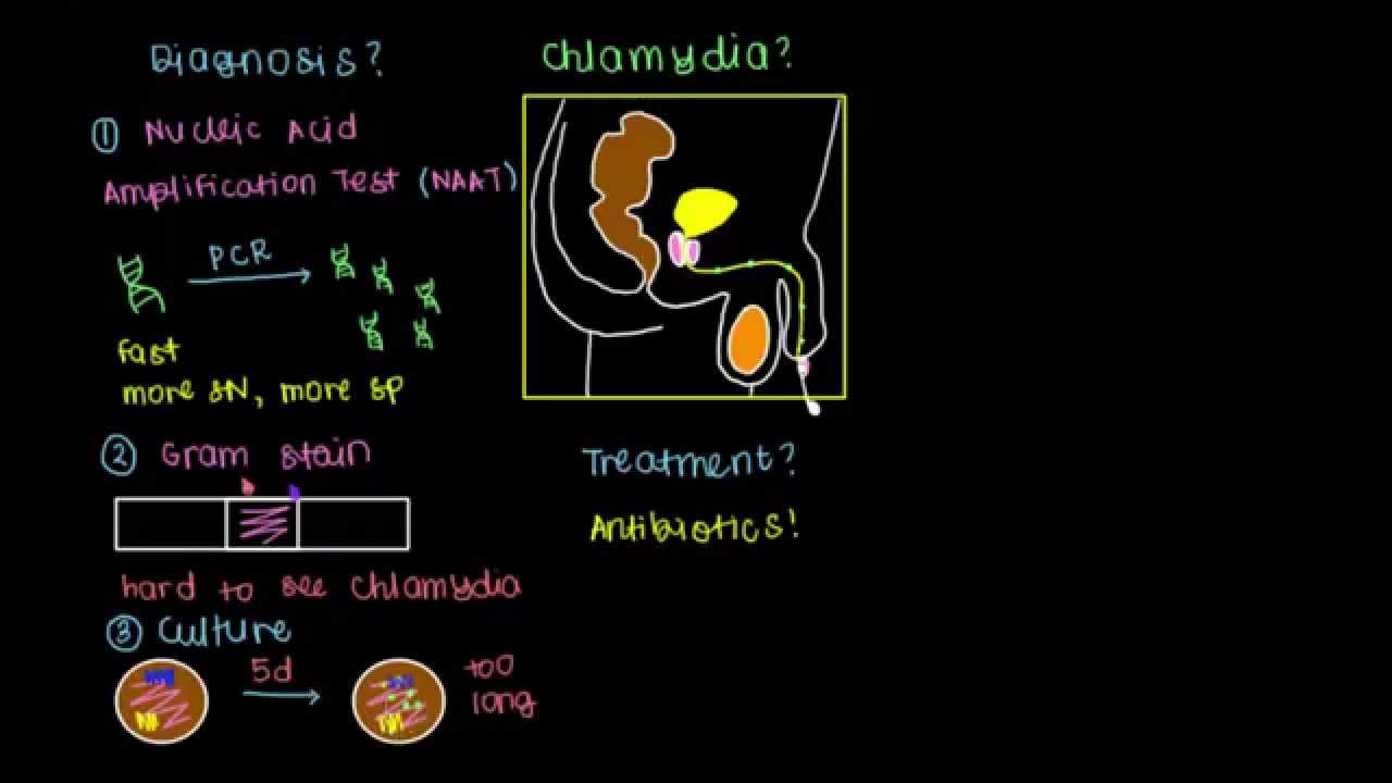 Diagnosis, Treatment, and Prevention of Chlamydia - YouTube