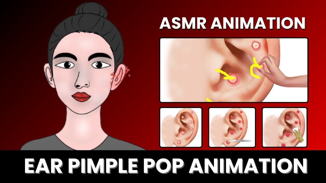 Ear Pimple Removal ASMR Animation | Satisfying Ear Cleaning Sounds ...