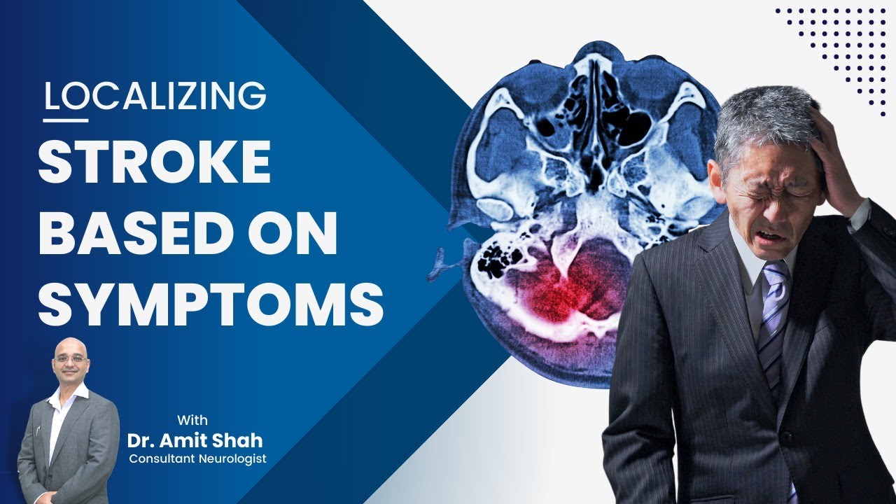 Stroke Localization | Localizing Stroke Based on Symptoms | Neurologist ...