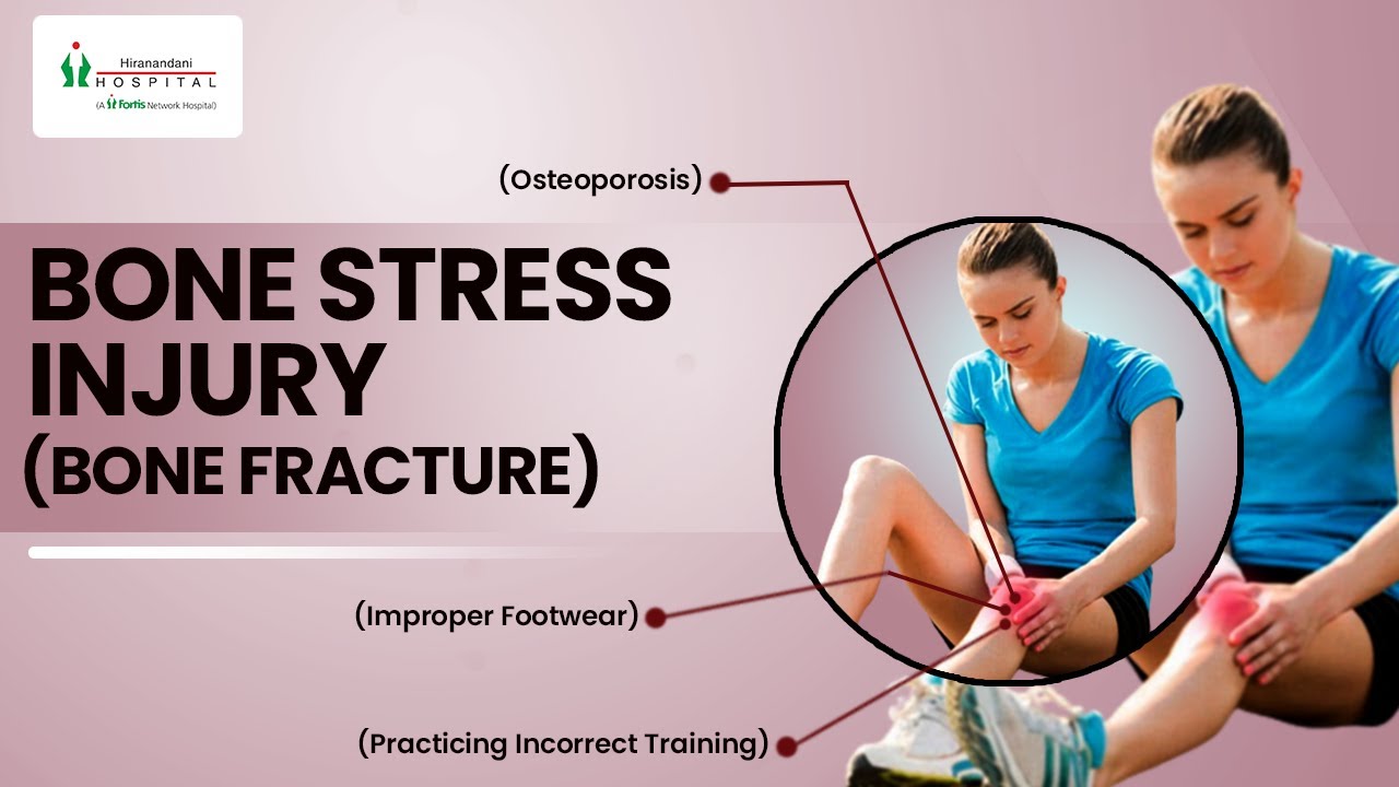 Bone Stress Injury | Shin Pain Kaise Thik Kare | Bone Fracture Recovery ...