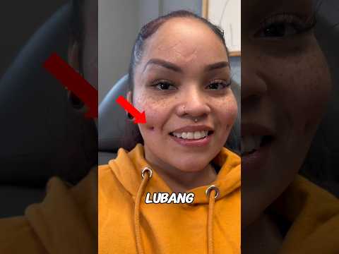 Kenapa Ada Lubang Di Pipi Seseorang ‼️😱