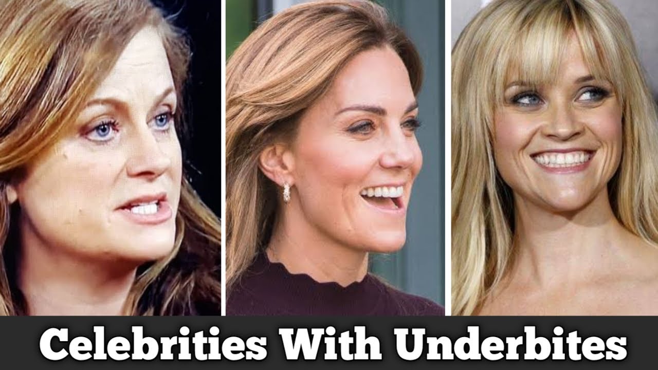 Celebrities With Underbites YOU MUST SEE!!! - YouTube