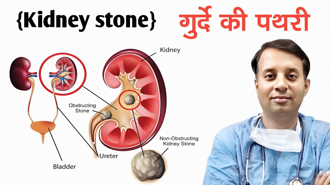 Kidney,Bladder,Prostatic,Ureteric Stone | Turp | turbt vvf | Dr Arawat ...