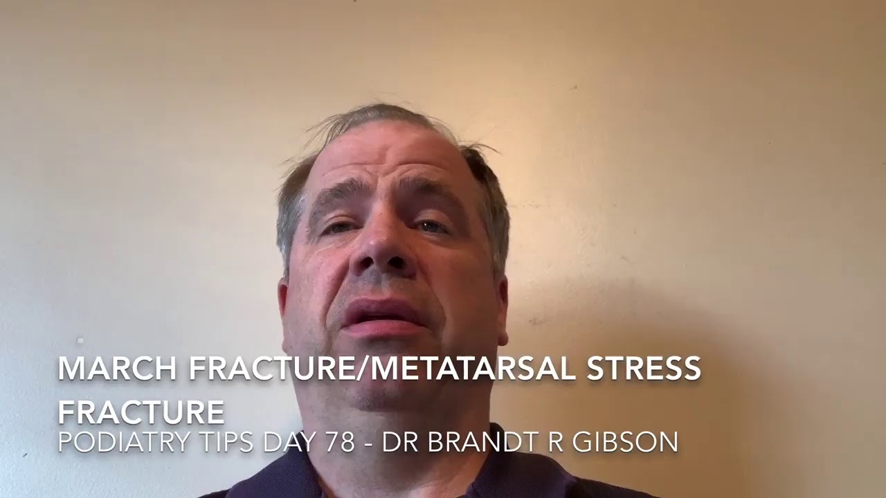 March Fracture/Sesamoid Stress Fracture - YouTube