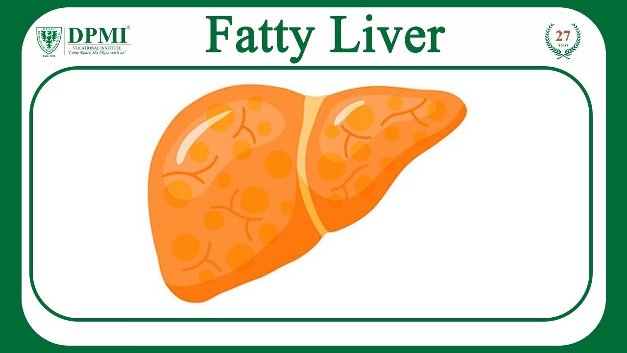 Fatty Liver: What is the Main Cause of Fatty Liver? What are the 4 ...