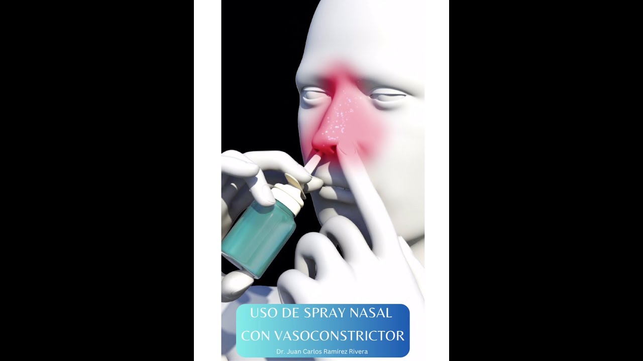 Qué sucede con el uso prolongado de los spray nasales con ...