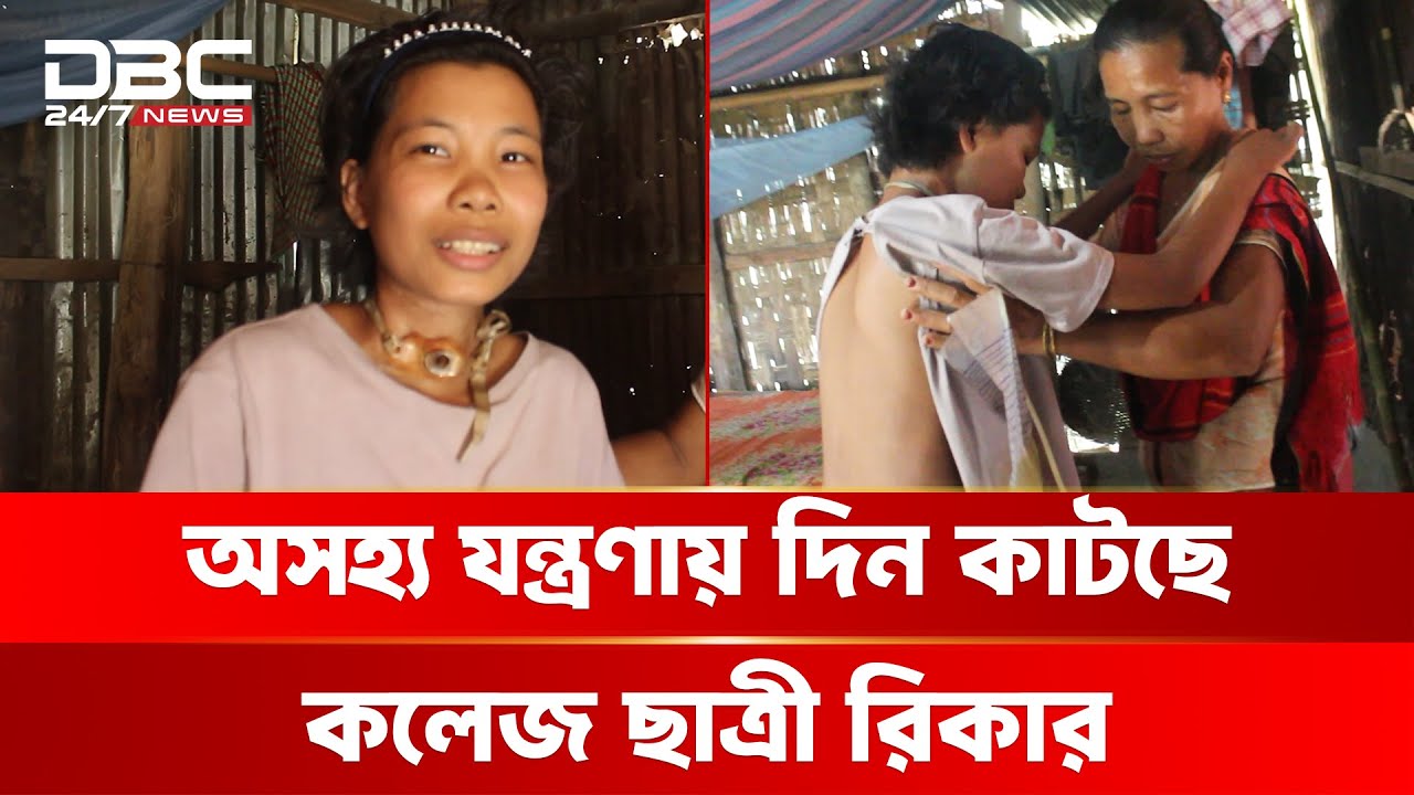 চলন্ত টমটমে ভ'য়া'ব'হ দু'র্ঘ'ট'না'য় অসহ্য যন্ত্রণায় দিন কাটছে কলেজ ...