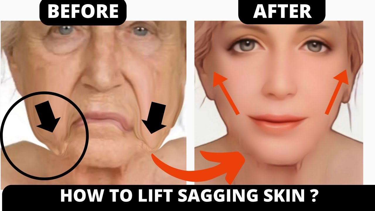 🛑 ANTI-AGING FACE LIFTING EXERCISES FOR SAGGING SKIN, JOWLS, LAUGH ...
