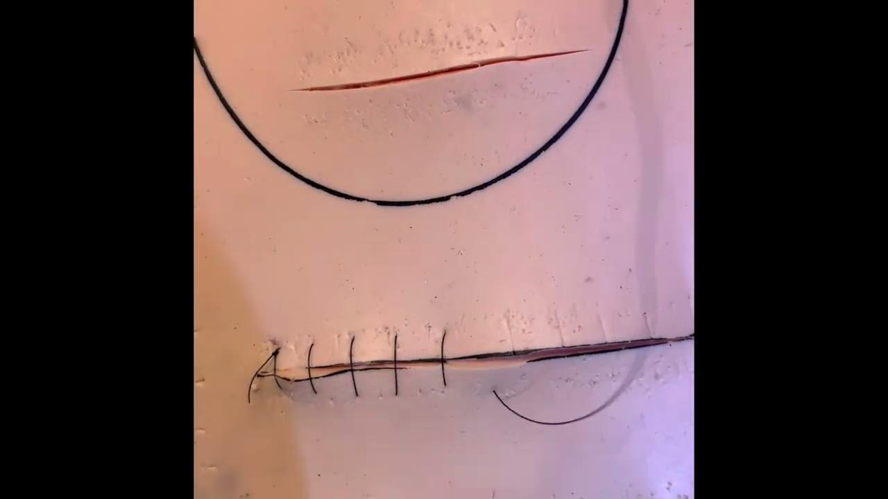 Simple Running Suture YouTube simple-running-suture-youtube