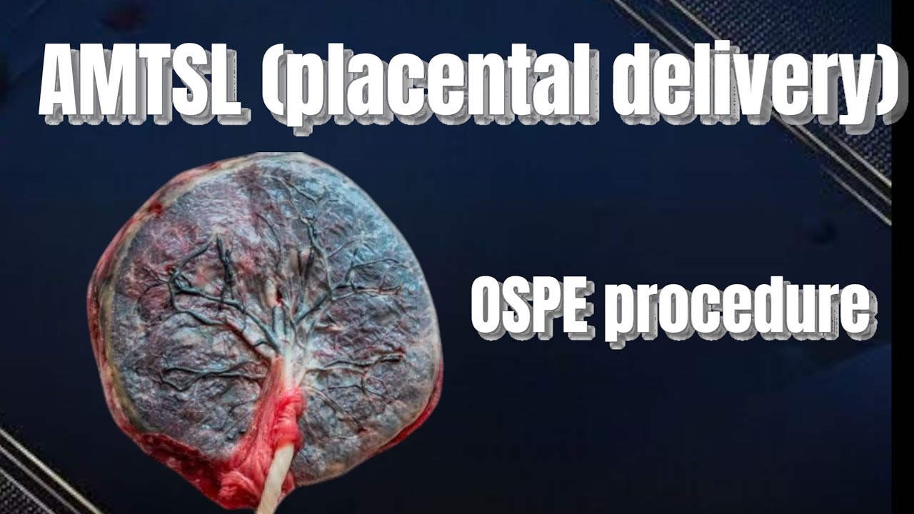 AMTSL procedure station obs & gynae OSPE - YouTube