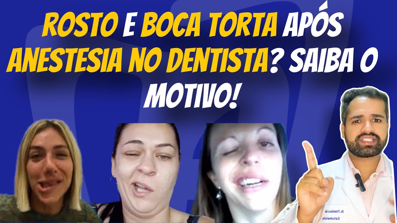Boca torta após anestesia no dentista? Saiba o motivo e como resolver ...