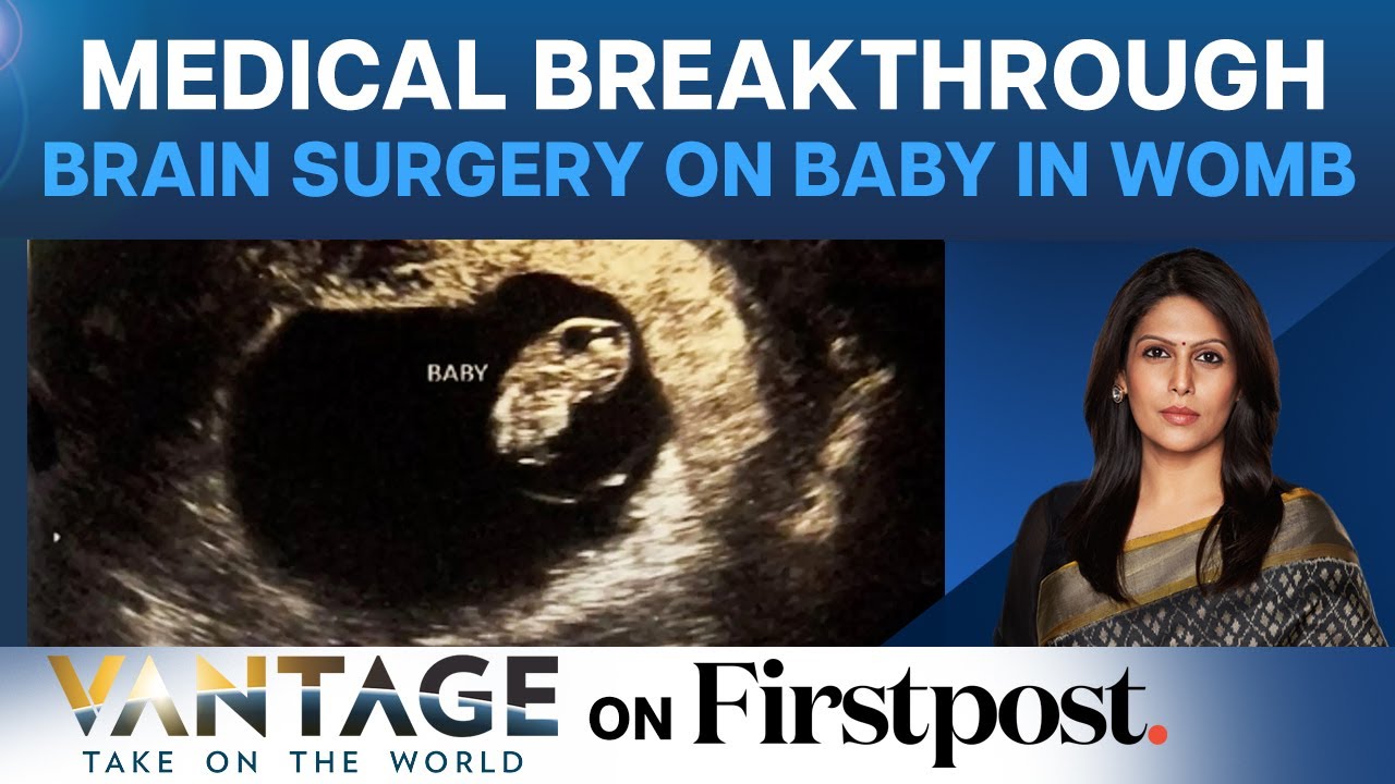 US: In a First, Doctors Perform Brain Surgery on Baby in Womb | Vantage ...