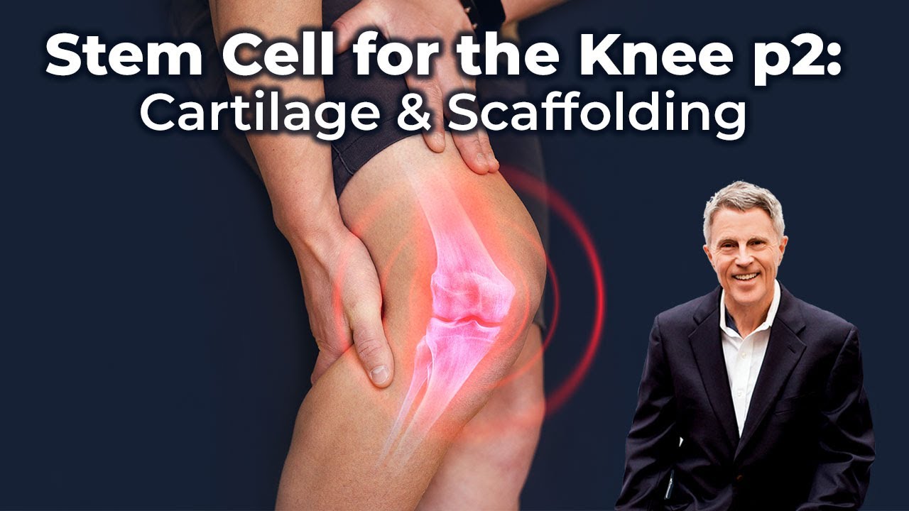 Stem Cell for the Knee part 2: Cartilage & Scaffolding- FORD BREWER MD ...
