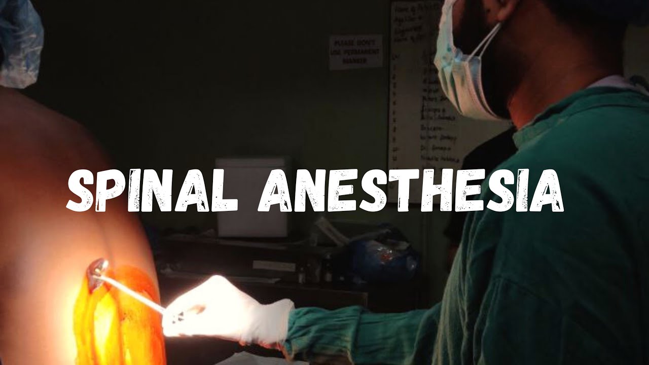 How to give spinal anesthesia ? LEARN IN 1 MINUTE - YouTube