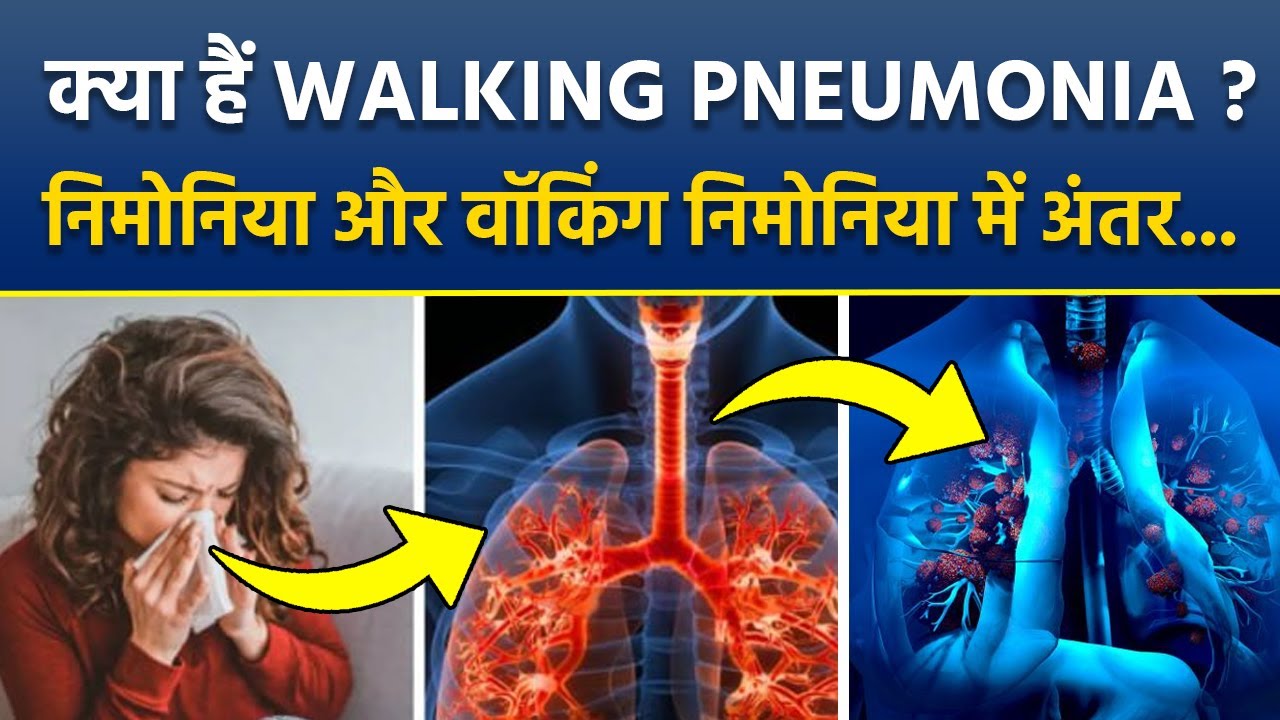 Walking Pneumonia Kya Hai, Pneumonia And Walking Pneumonia Difference ...