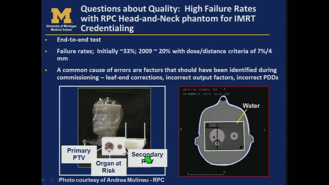 SRS/SBRT - Safety Considerations for IMRT and SRS/SBRT - By Jean Moran ...