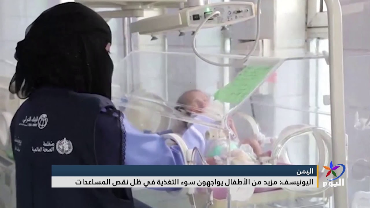 اليونيسف مزيد من أطفال اليمن يواجهون سوء التغذية في ظل نقص المساعدات