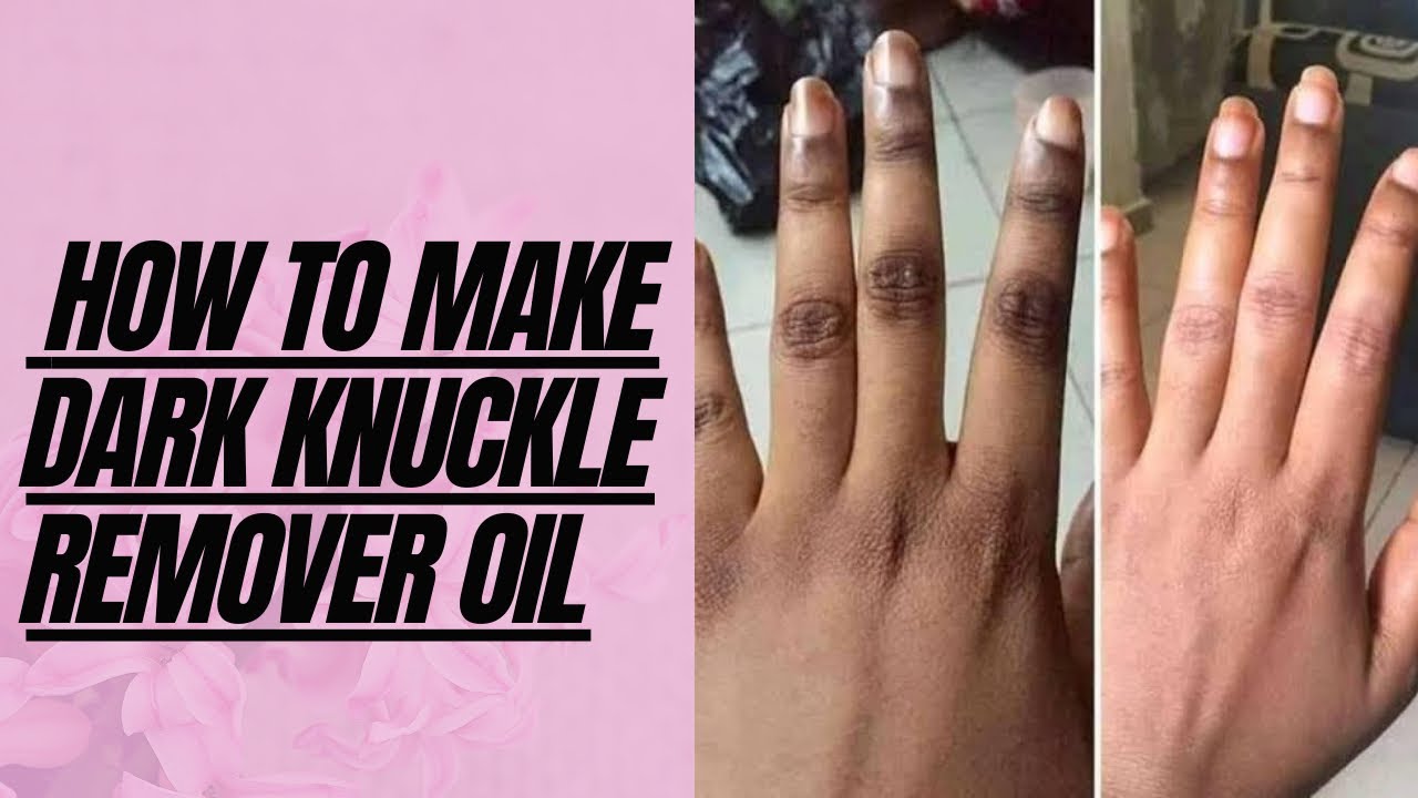 HOW TO MAKE 14DAYS KNUCKLE REMOVER OIL - YouTube