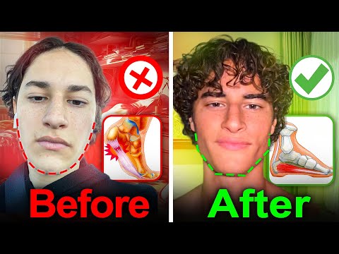 Die Form Ihrer Füße macht Sie hässlich (Faszien-Guide)