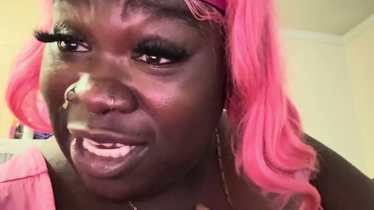 I Got All My Top Teeth Removed 😳 | Raw & Real Dental Surgery + Healing ...