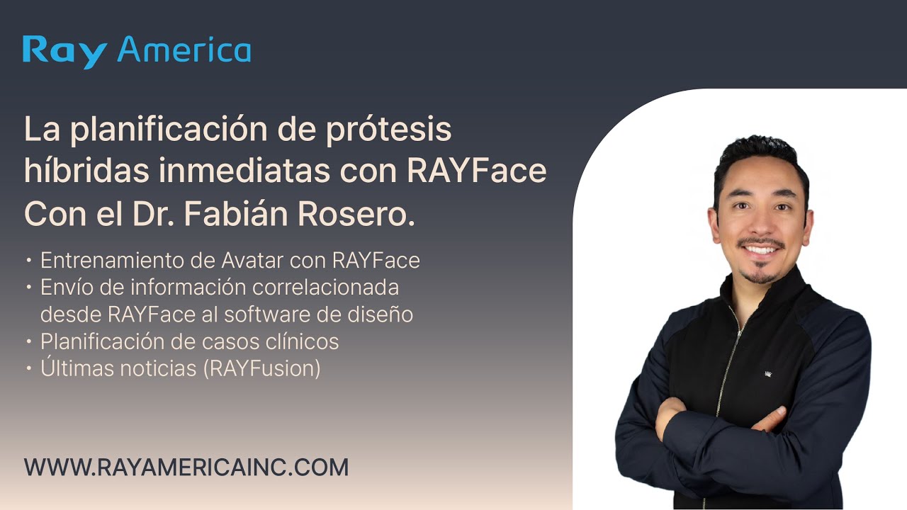 Fabián Rosero - The Planning of Immediate Hybrid Prostheses with RAYFace - YouTube