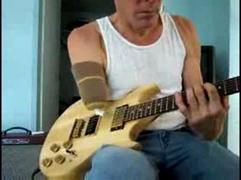 A Guy With One Arm Plays The Guitar! - YouTube