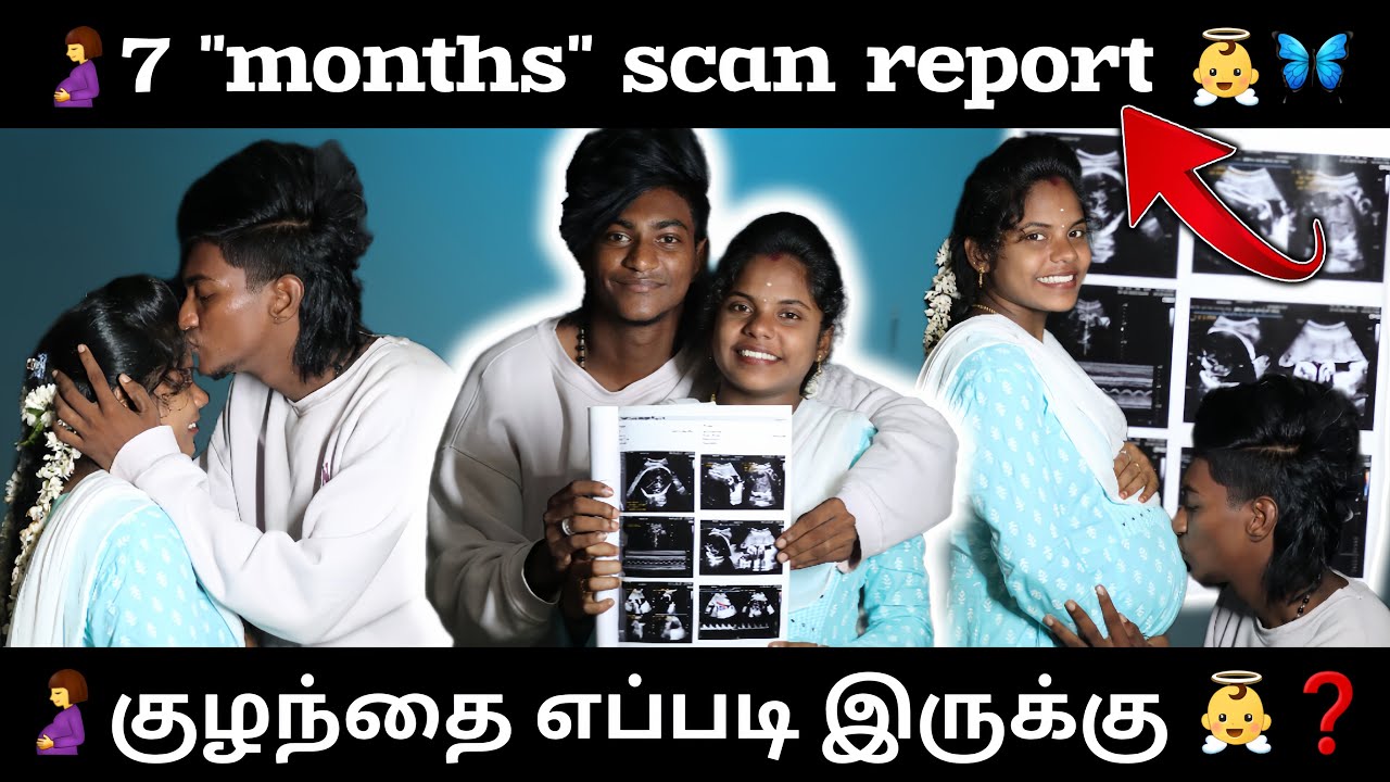 🤰Pregnancy "7 months" scan report 👼🦋.@butterfly_couples #pregnancy # ...
