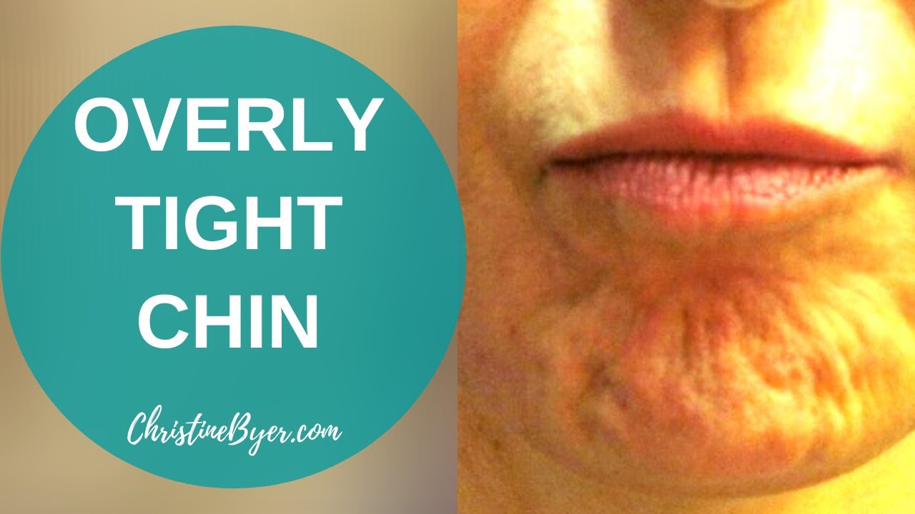 DIMPLY CHIN? HOW TO IMPROVE - YouTube