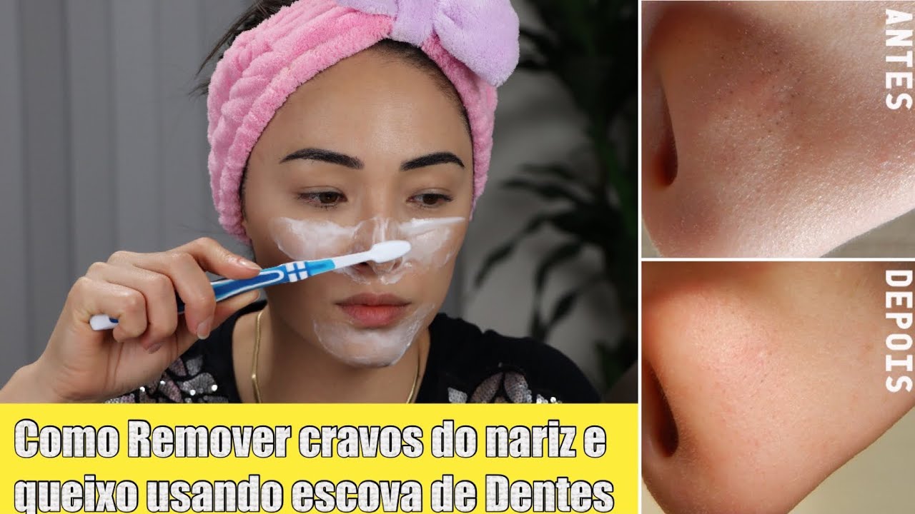 COMO REMOVER #CRAVOS DO NARIZ E QUEIXO COM A ESCOVA DE DENTE NA HORA ...
