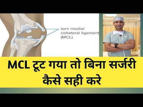 MCL लिगामेंट की चोट की सारी जानकारी पहली बार सरल हिंदी में (Complete ...
