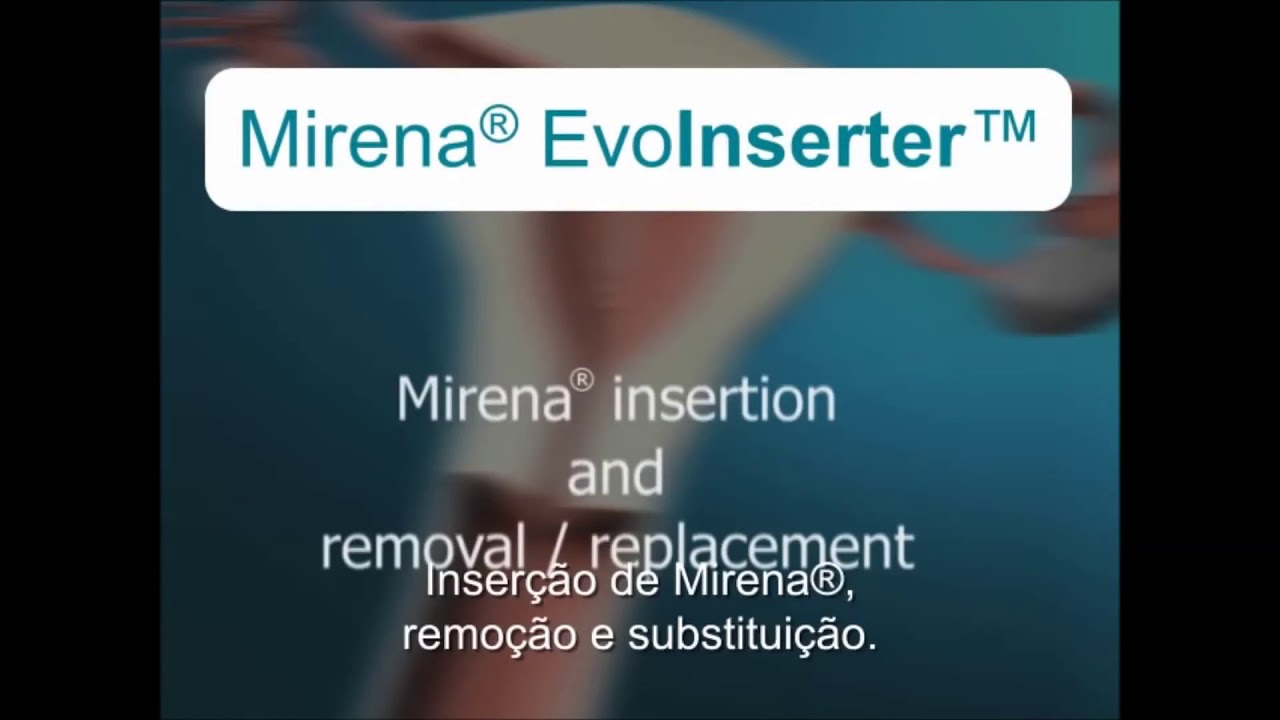 Mirena insertion and removal - YouTube