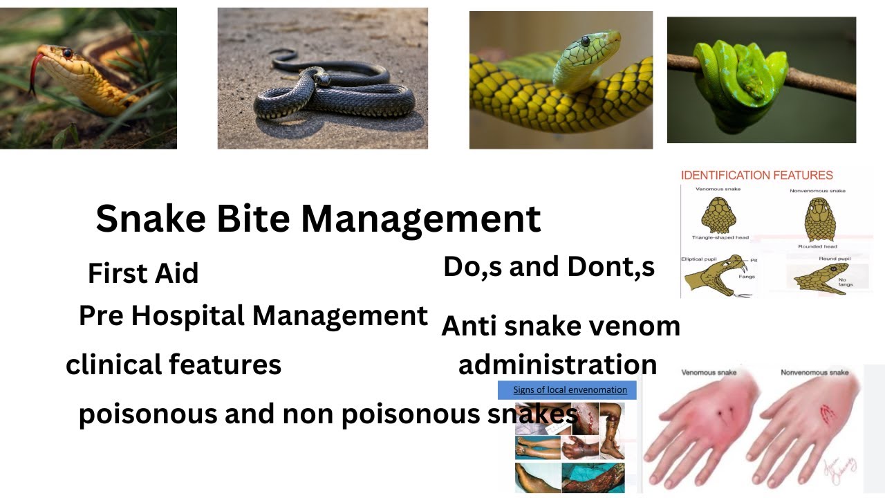 snake bite management, First aid , emergency treatment , management in ...