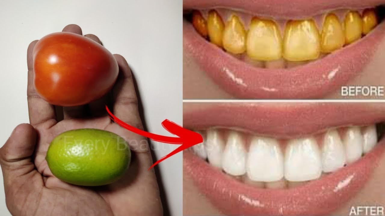 How to Whiten Teeth in Less Than 2 Minutes Get White Teeth Forever ...