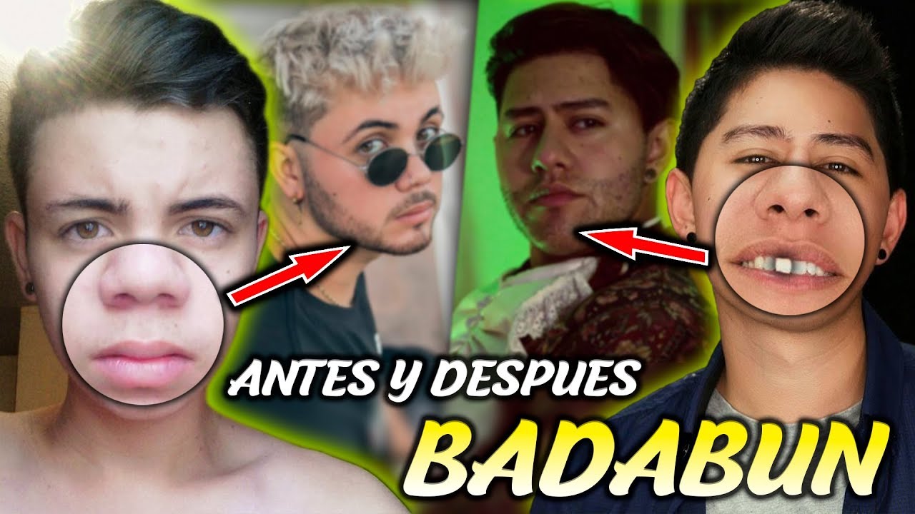 No Eran Tan Bonitos. Antes Y Despues De Badabun - YouTube