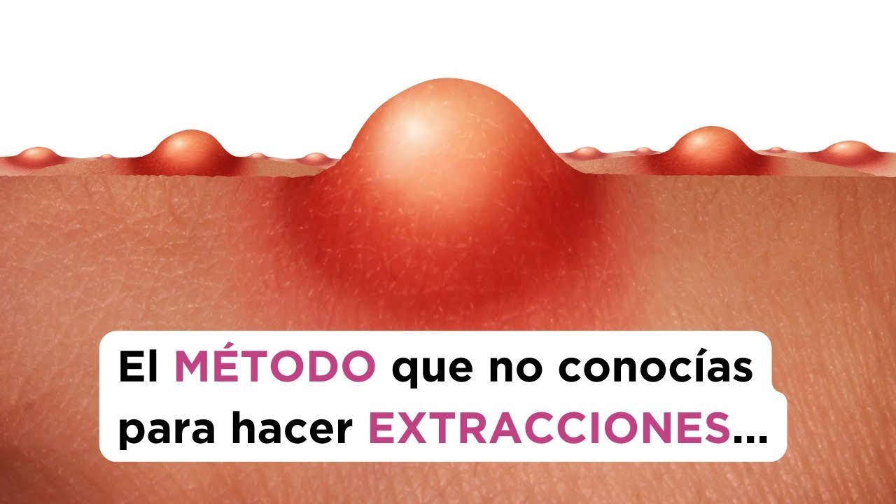 El método que no conocías para hacer extracciones - YouTube