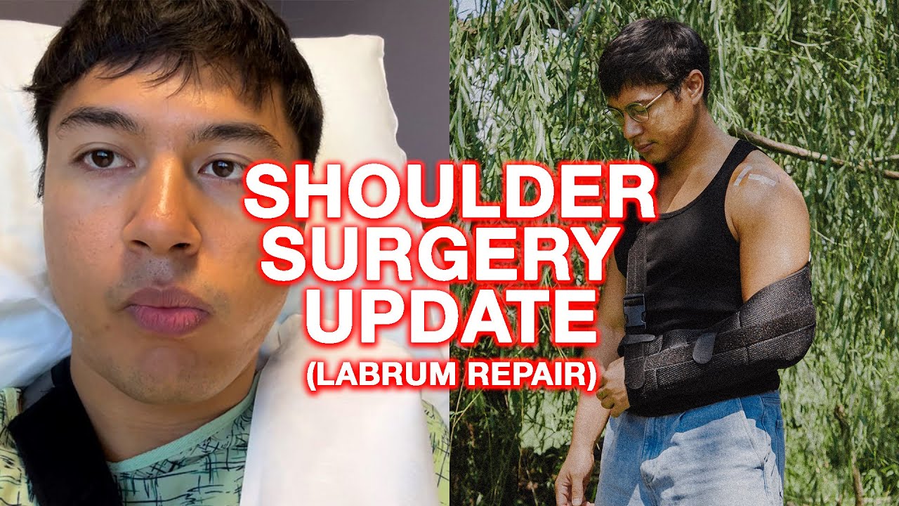 Labrum Surgery Recovery: Week 1-8 (What to Expect) - YouTube
