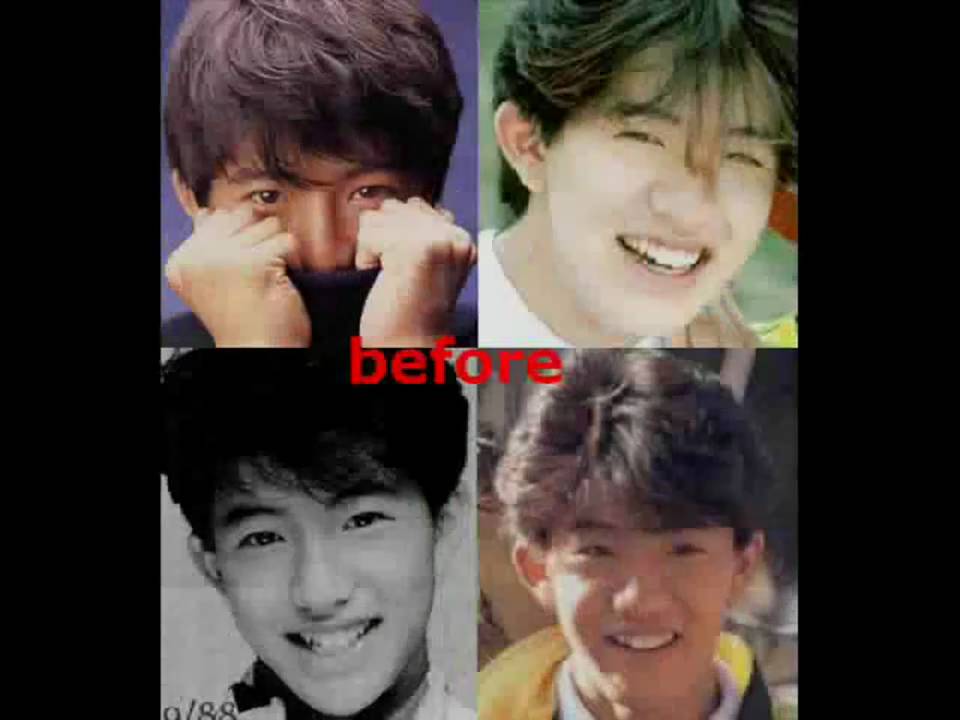 TVXQ DBSK Before and After plastic surgery 東方神起 整形 tohoshinki pre debut ...
