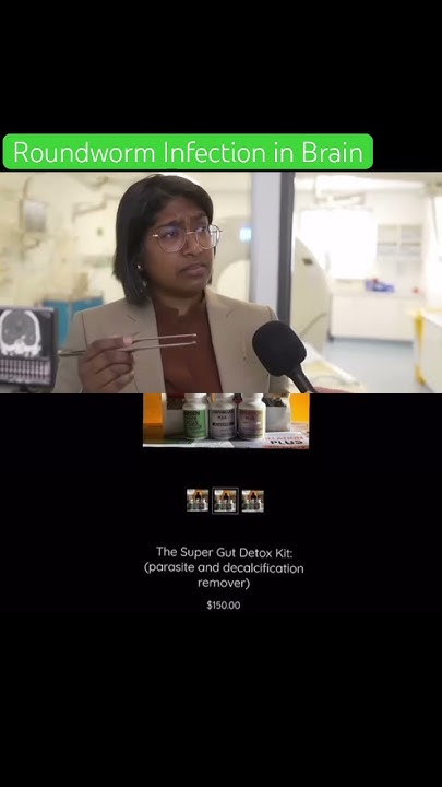 Roundworm Infection in Women’s Brain. - YouTube