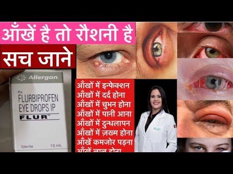 Flurbiprofen eye drops | Flurbiprofen eye drips Ip in hindi | Flur eye ...