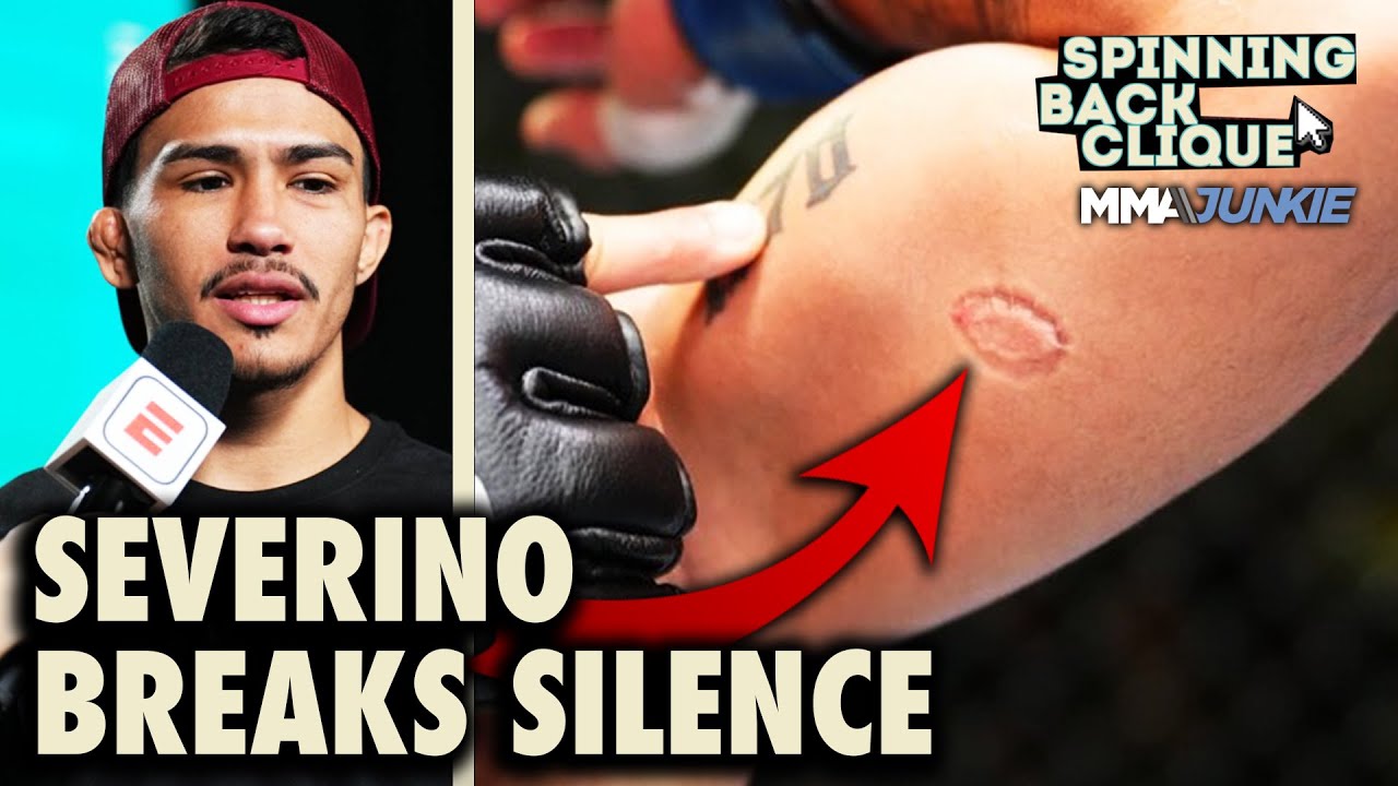 REACTION: Igor Severino Breaks Silence on His Biting Incident at UFC on ...