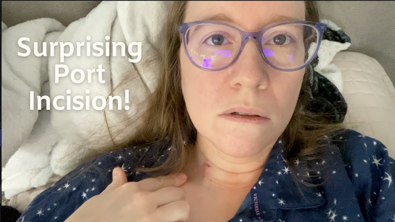 Surprising Port a Cath incision! (Day of Surgery) - YouTube
