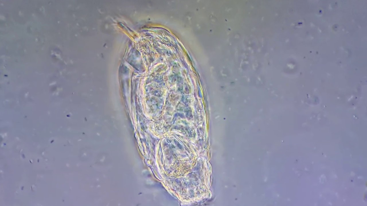 Коловратка Lecane inermis. 1000х \ Rotifer Lecane inermis. 1000x - YouTube