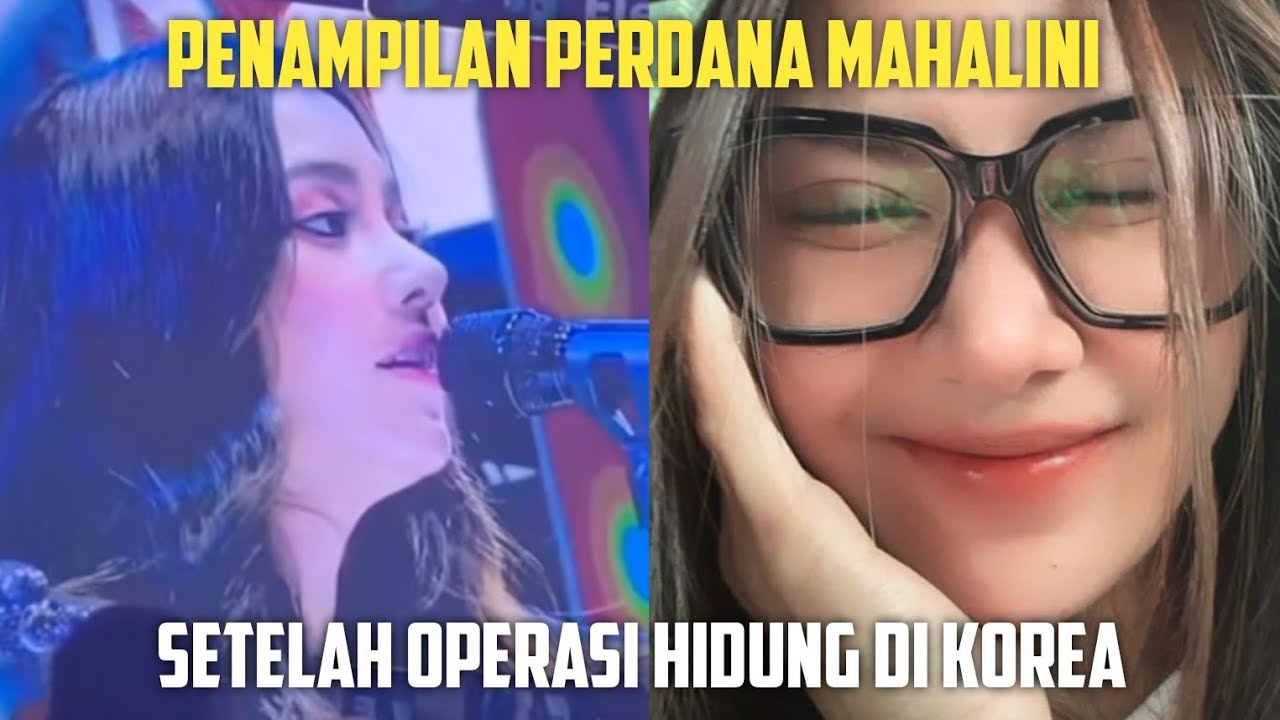 PENAMPILAN PERDANA MAHALINI SETELAH OPERASI HIDUNG DI KOREA - YouTube