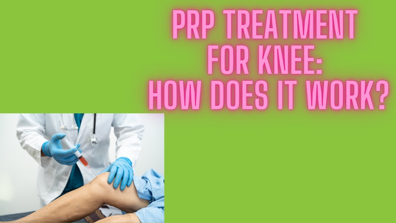 PRP Treatment for Knees: My Platelet Rich Plasma Experience - YouTube